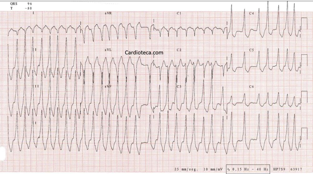 ECG 06 Agosto 2018