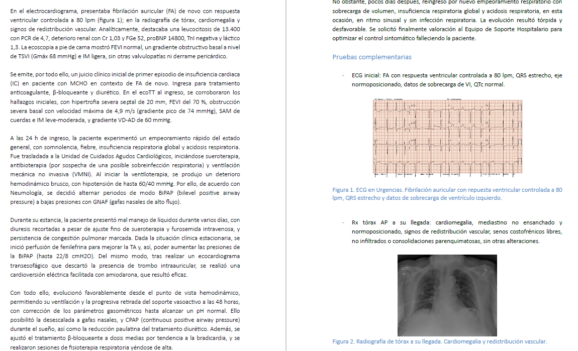 Miocardiopatía hipertrófica, obesidad y fibrilación auricular: una ...